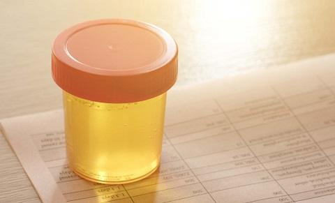 Rapid Urine Drug Testing – OnSITE
